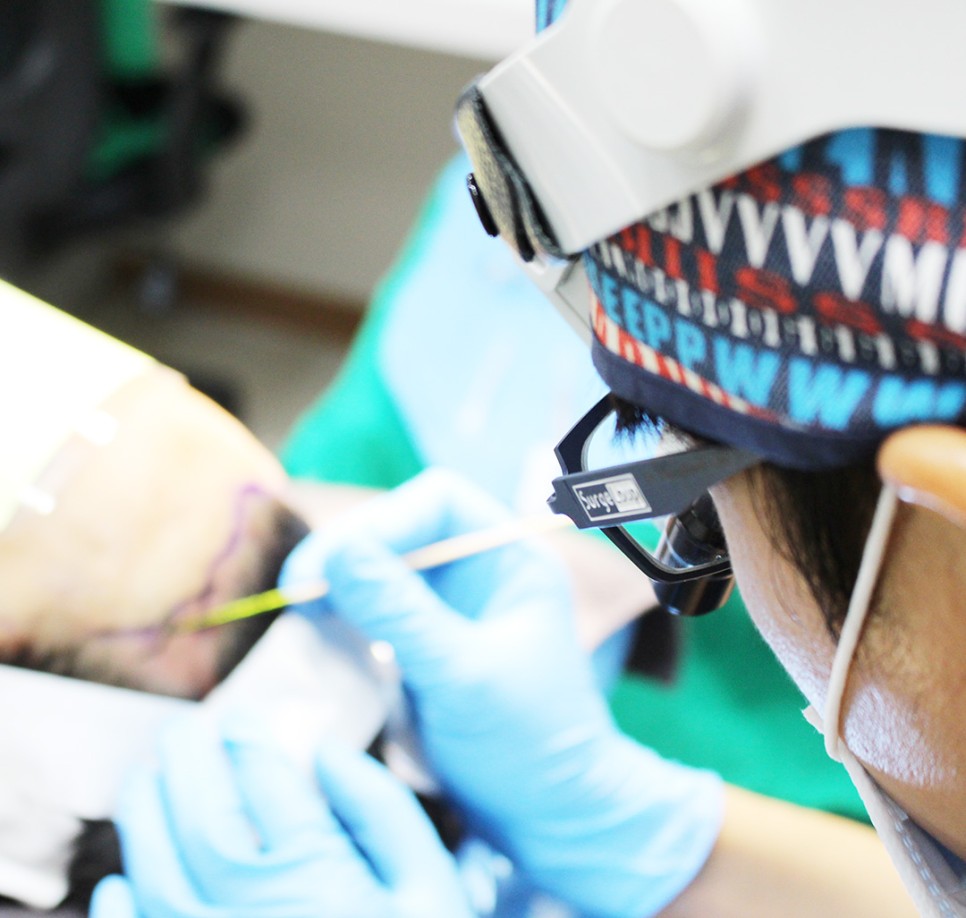 Things to Consider Upon Choosing Incision/FUE Hairline Correction ...