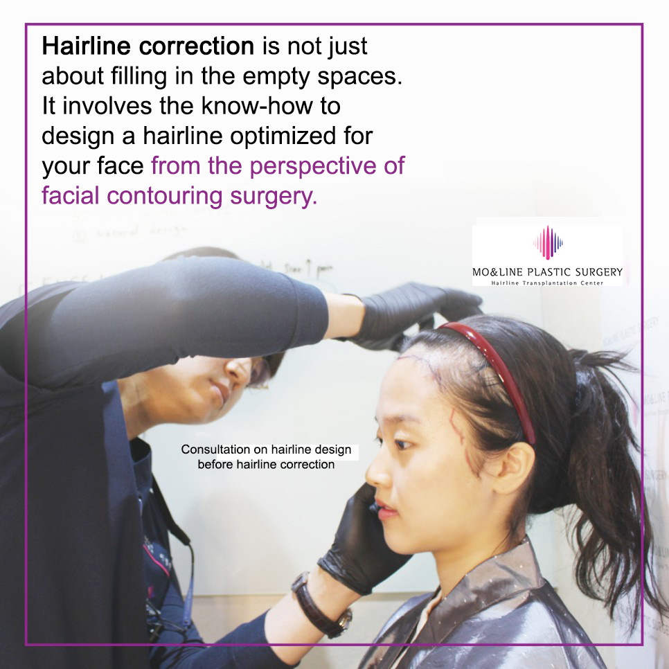 The Challenge of Producing Fine, Thin Hairs in Hair Transplant Surgery ...